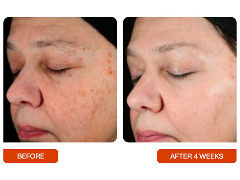 Beautystat Universal C Skin Refiner