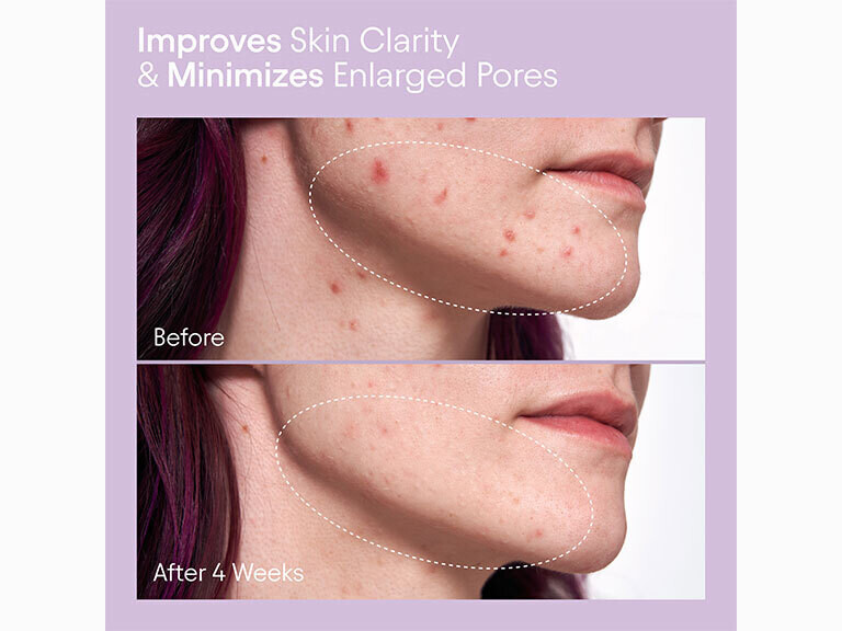 Alpyn Beauty Pore Perfecting Liquid
