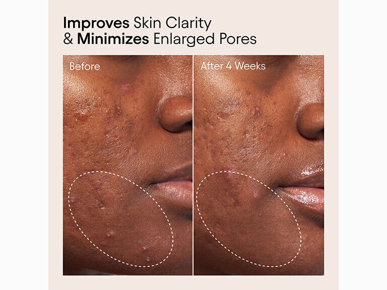 Alpyn Beauty Pore Perfecting Liquid